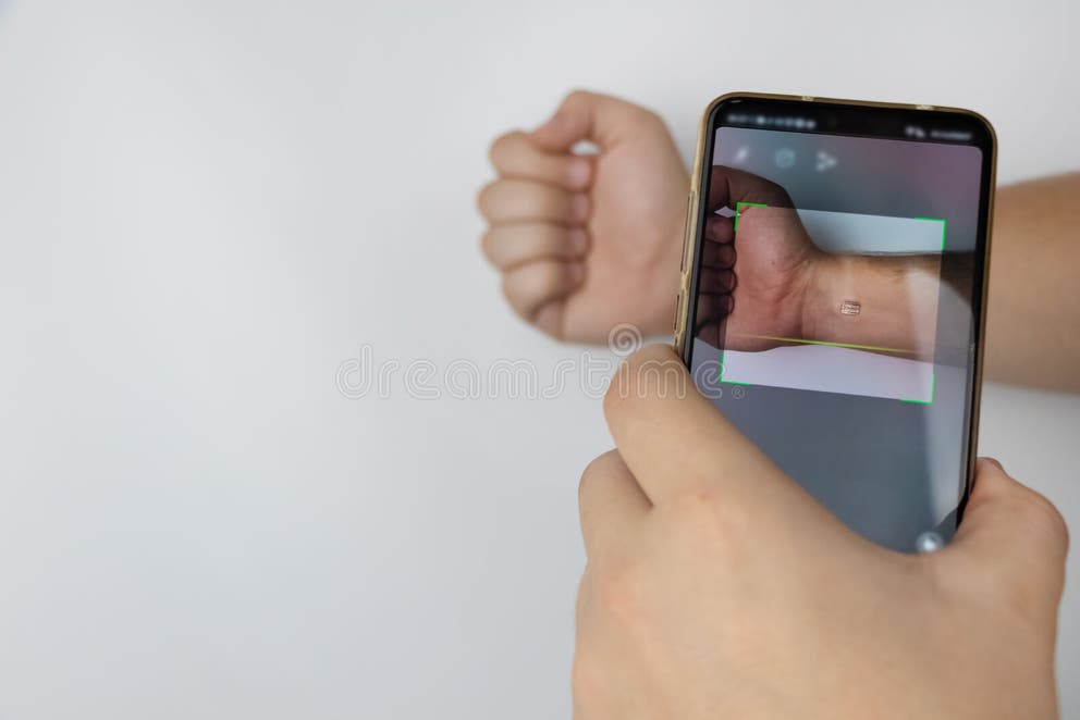 A Man Reads Data Using a Special Device from an Implanted Chip in a Man ...