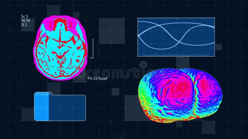 MRT Scan stock photo. Image of hospital, negative, doctor - 15747090