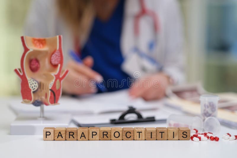 Gaining a Comprehensive Understanding of Paraproctitis Valuable Medical ...