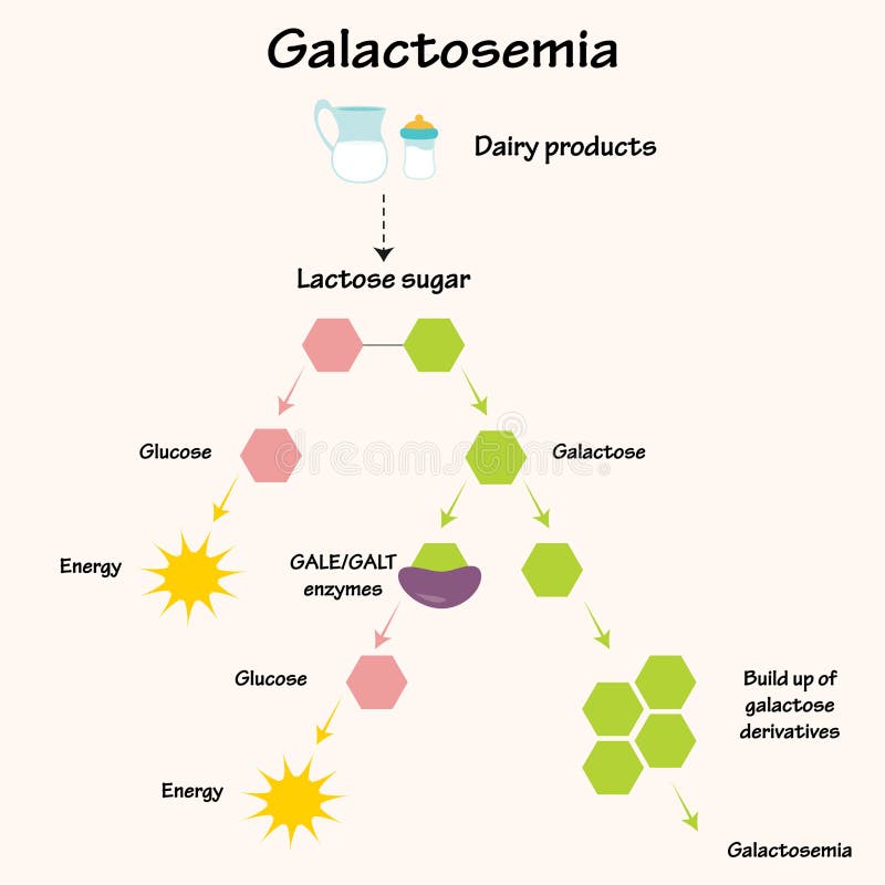 Galactosemia Vector Illustration Diagram Stock Vector - Illustration of ...