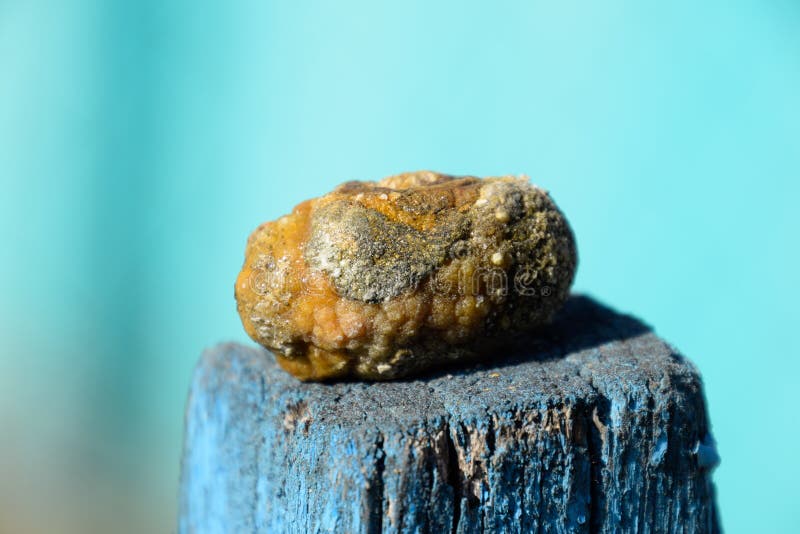 Gallstones Voorraadbeelden - Download 139 Royalty Vrije Foto's