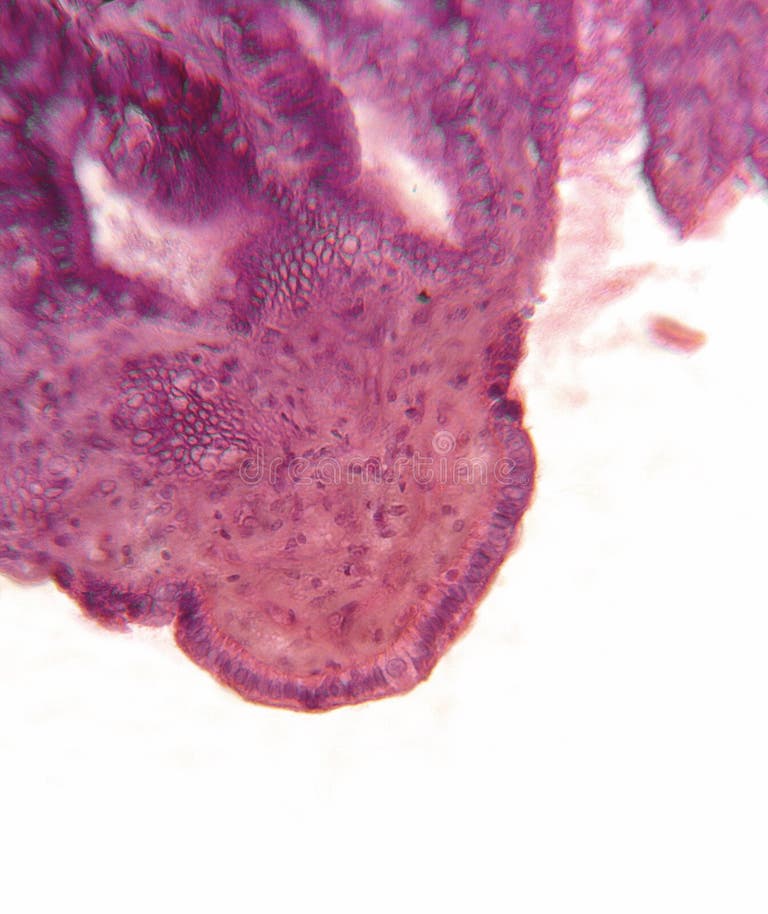 Gall Blader Histology Stock Photos - Free & Royalty-Free Stock Photos ...