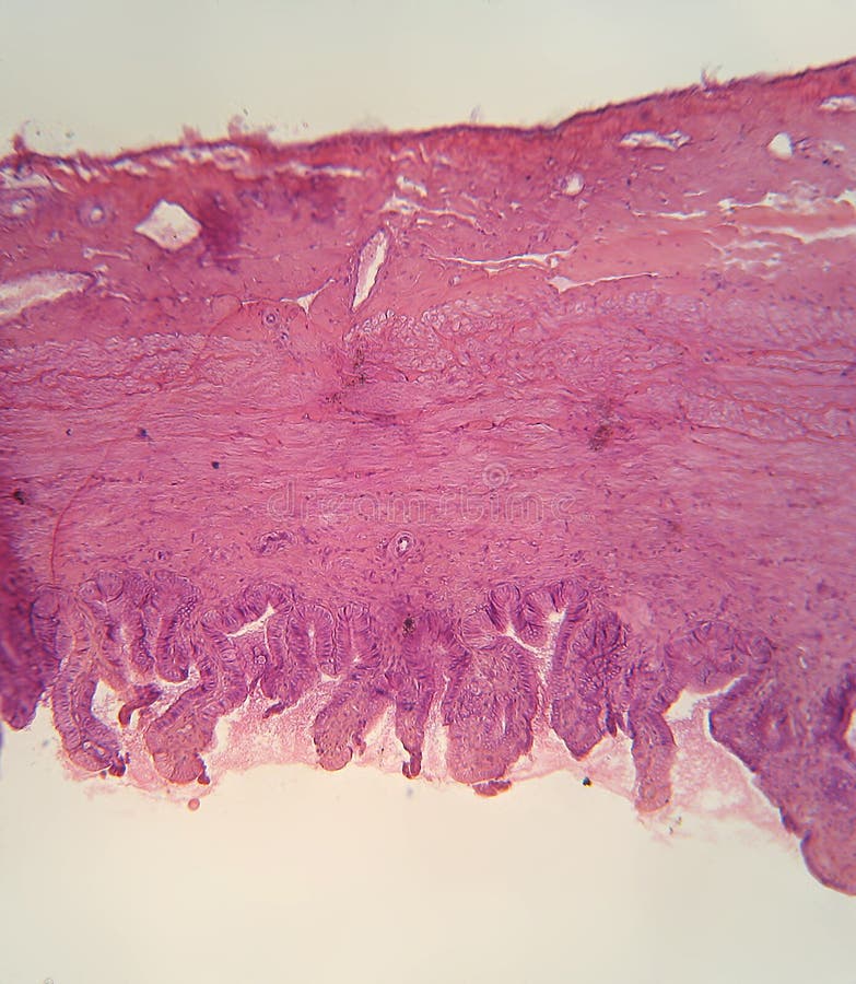 Gall Bladder, Microscopic Cross Section Stock Photo - Image of medicine ...