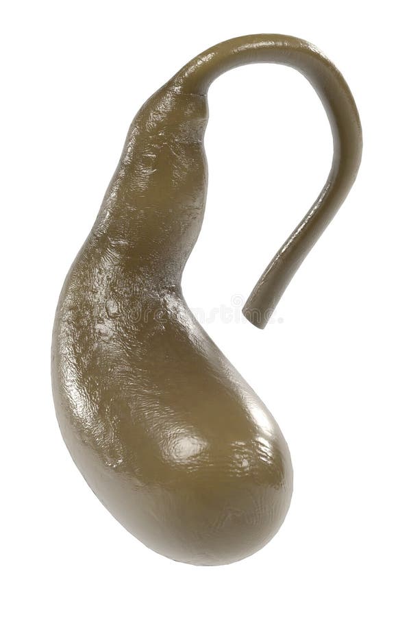 Gallbladder organ stock illustration. Illustration of operation - 70616002