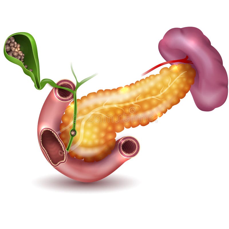 Gallstones stock vector. Illustration of bladder, education - 35705970