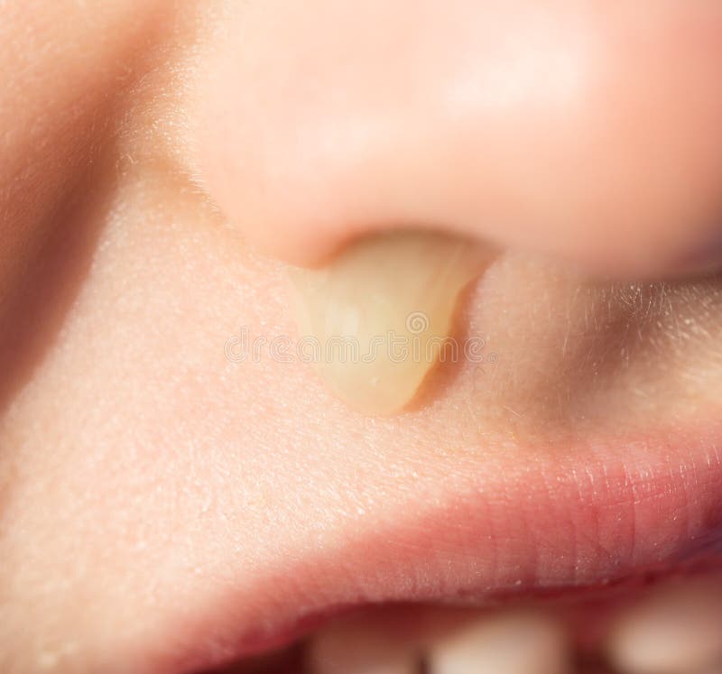 Homme Essuyant La Morve Par Sa Main Image stock - Image du allergie ...