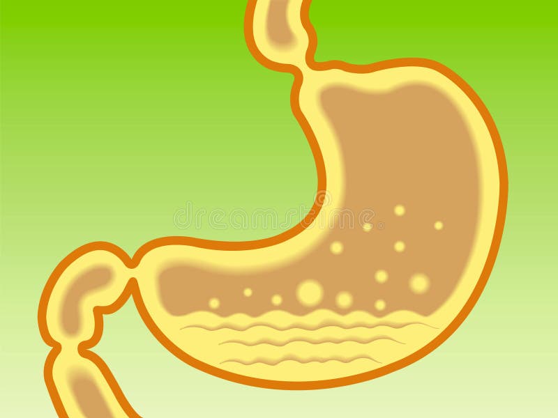 Gastric acidity stock vector. Illustration of pathology - 20315775