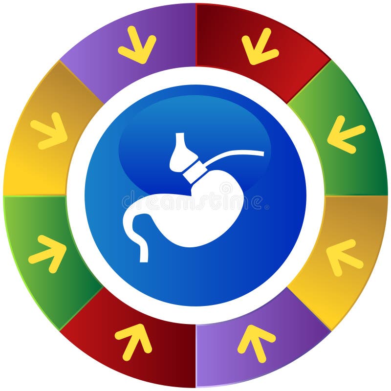 Gastric Bypass Button Stock Illustrations – 3 Gastric Bypass Button ...