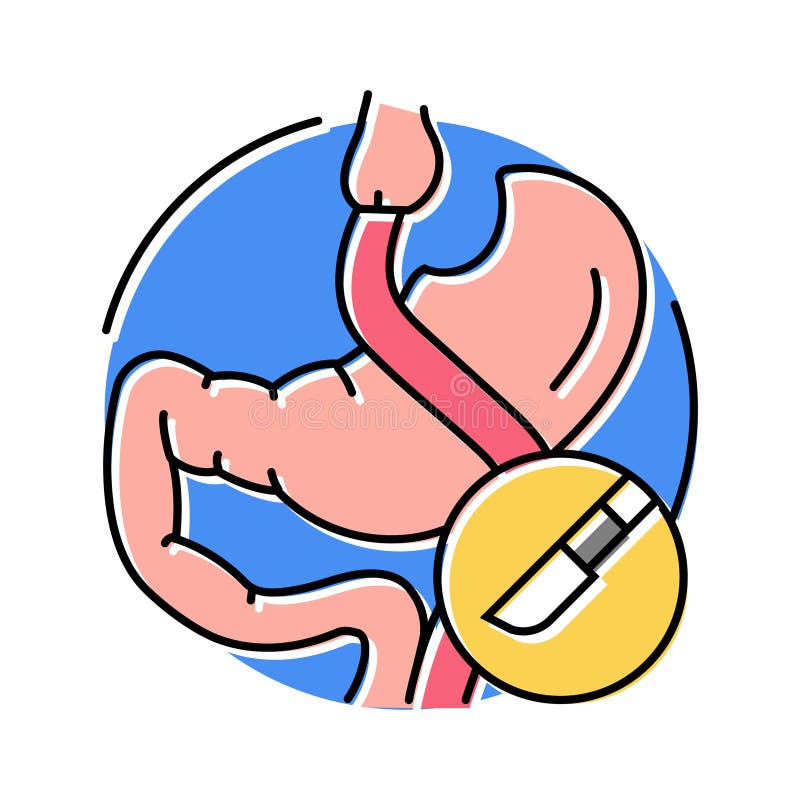 Gastric Bypass Patient Stock Illustrations 141 Gastric Bypass Patient Stock Illustrations