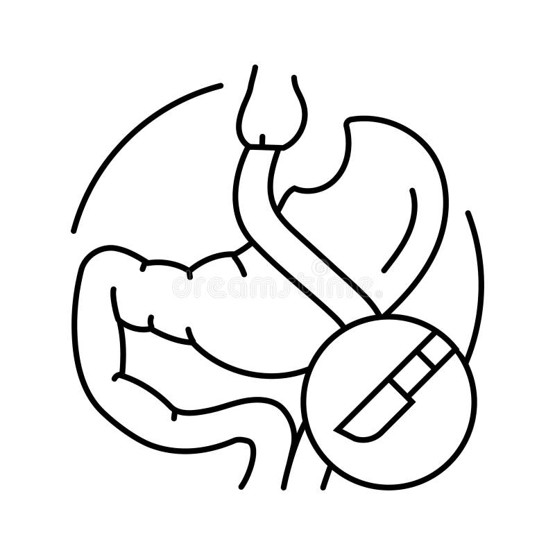 Gastric Bypass Gastroenterologist Line Icon Vector Illustration Stock Illustration