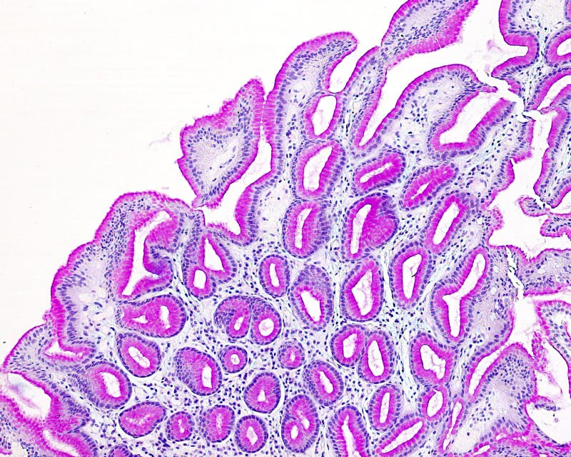 Pas Mucosa Intestino Stock Photos - Free & Royalty-Free Stock Photos ...