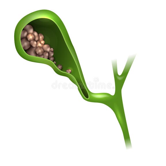 Geïsoleerde galstenen vector illustratie. Illustration of lichaam ...