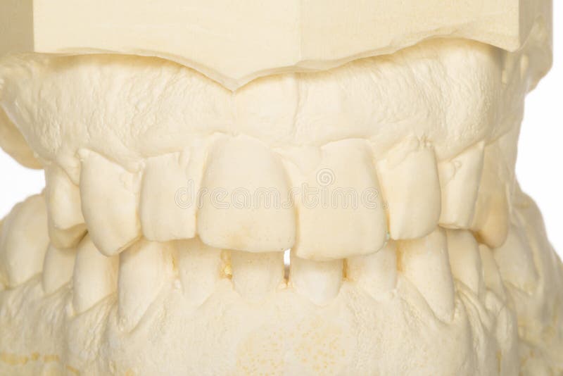 Gebit stock afbeelding. Image of indruk, prothese, geïsoleerd - 29676249