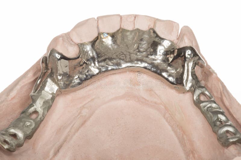 Gebit stock foto. Image of gebit, mondeling, laboratorium - 29676424