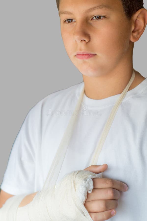 Gebrochener Arm stockfoto. Bild von zicklein, verletzung - 63607770