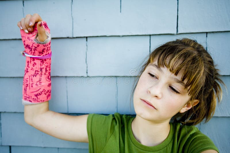 Gebrochener Arm stockfoto. Bild von verletzt, moping, verband - 758598