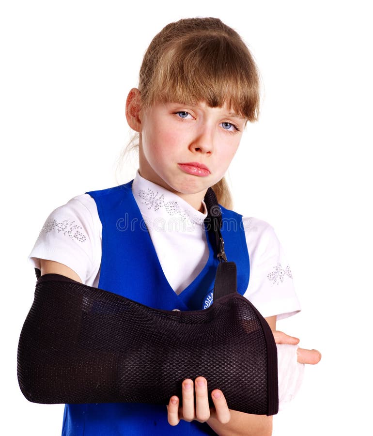 Gebrochener Arm In Einer Form. Stockbild - Bild von form, gebrochener ...