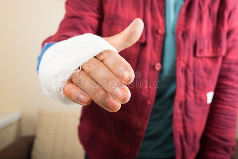 Gebroken hand met verband stock afbeelding. Image of terugwinning ...