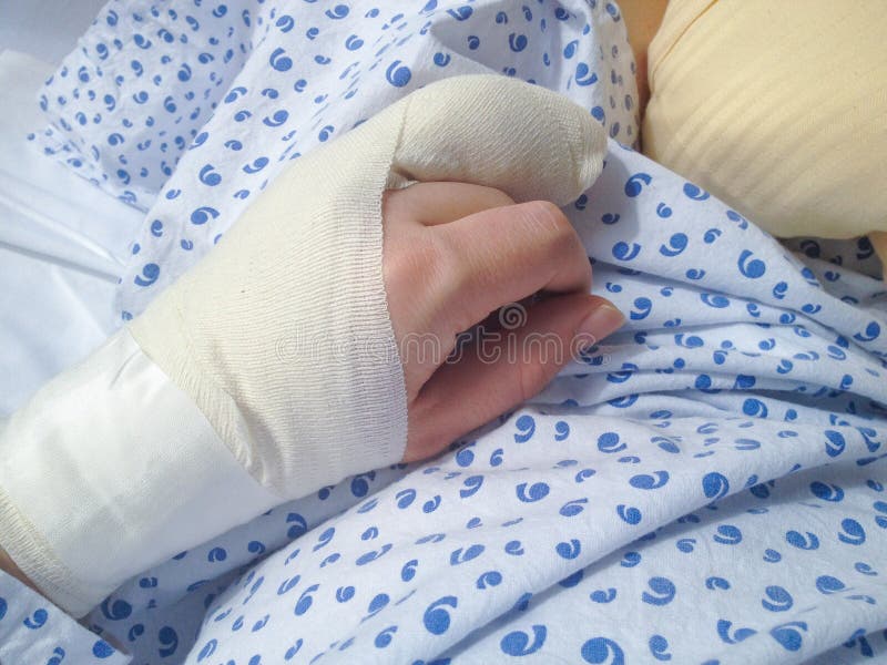 Gebroken Vinger Na Chirurgie Stock Afbeelding - Image of ongeval ...