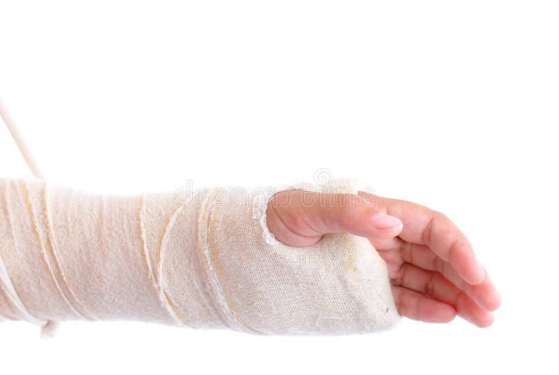 Gebroken Vinger stock afbeelding. Image of gezondheid - 3822359