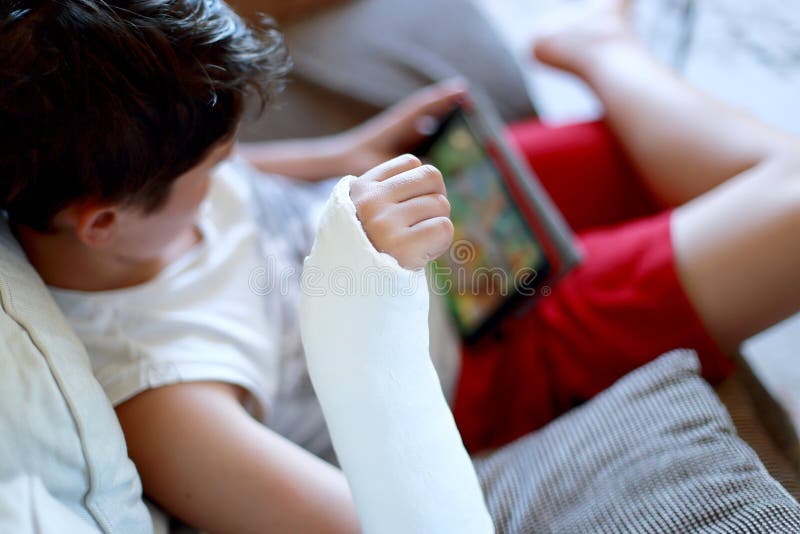 Gebroken Wapen stock foto. Image of vinger, lang, verband - 95113004