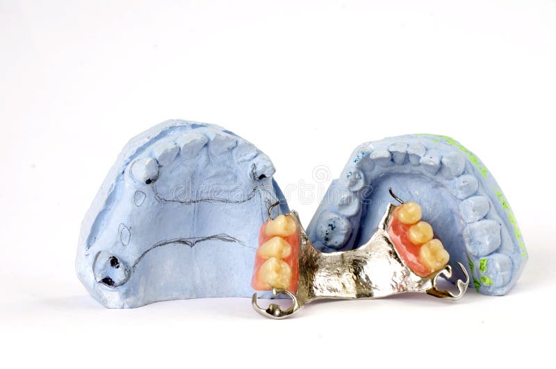 Kunstgebit 2 stock foto. Image of gebit, plaat, prothese - 2535008