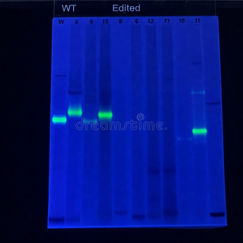 DNA Bands Gel Wild Type (Generated with AI) Stock Image - Image of ...