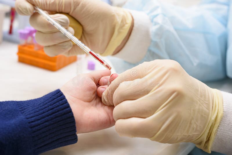 Blood Test from Finger stock image. Image of test, hospital - 137600213