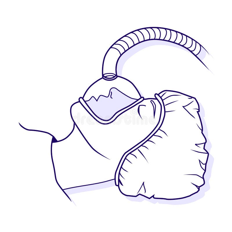General Anesthesia. Vector Outline Illustration Stock Illustration ...