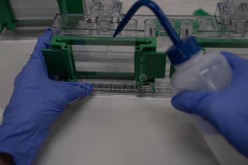 The General Process Preparation for Protein Levels Detection is Using ...