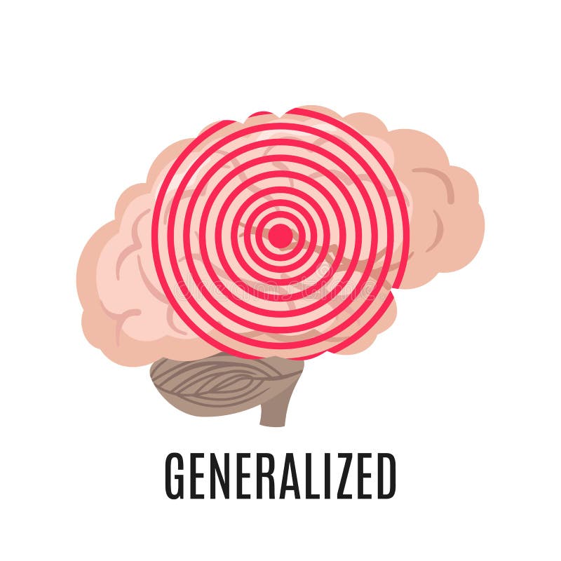 Generalized Epilepsy Icon Isolated on White Backround. Medical ...