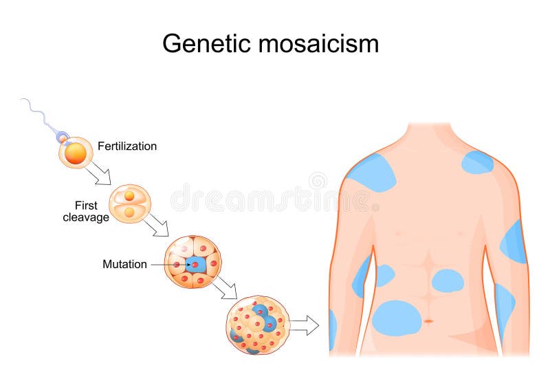 Genetic Mosaicism. Somatic Mutation Stock Vector - Illustration of ...