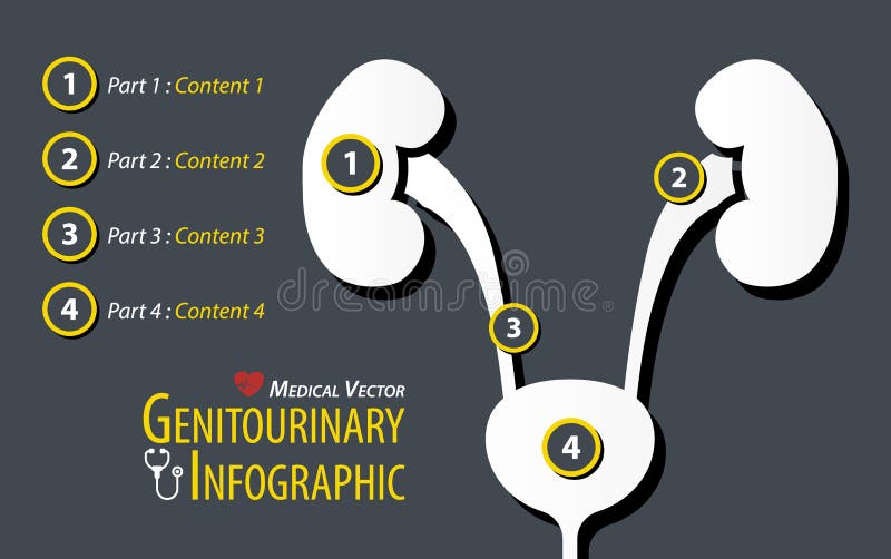 Genitourinary Infographic . Flat Design Stock Vector - Illustration of ...
