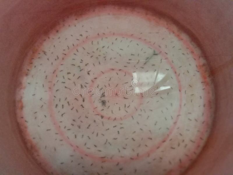 Germs in the bucket?? stock image. Image of bucketin - 303953425