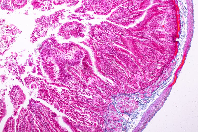 Gewebe Des Dünndarms Oder Des Dünndarms Unter Dem Mikroskopischen ...