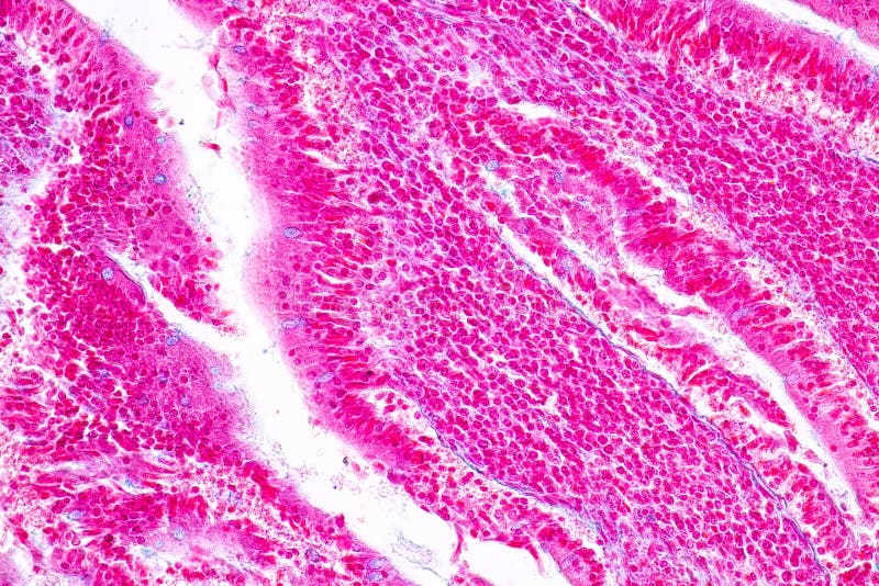 Gewebe Des Dünndarms Oder Des Dünndarms Unter Dem Mikroskopischen ...