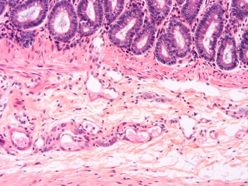 Gewebelehre Des Menschlichen Gewebes Stockbild - Bild von sehne ...