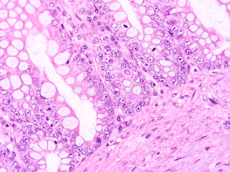 Gewebelehre Des Menschlichen Gewebes Stockbild - Bild von ansicht ...