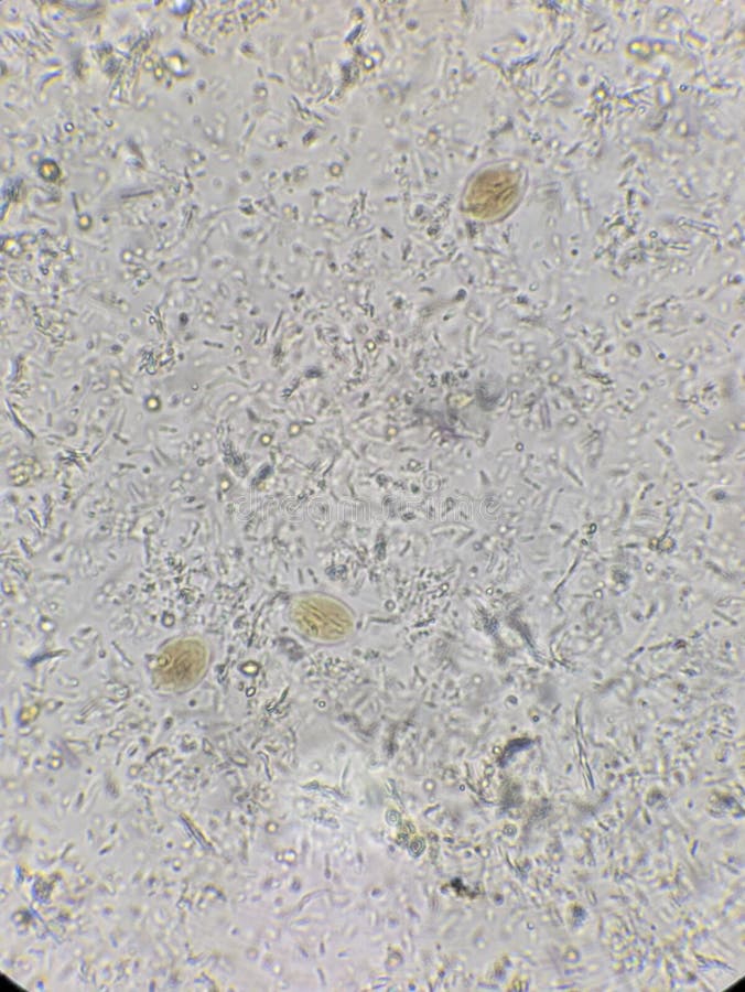 Giardia Intestinalis Cysts Stock Photos - Free & Royalty-Free Stock ...