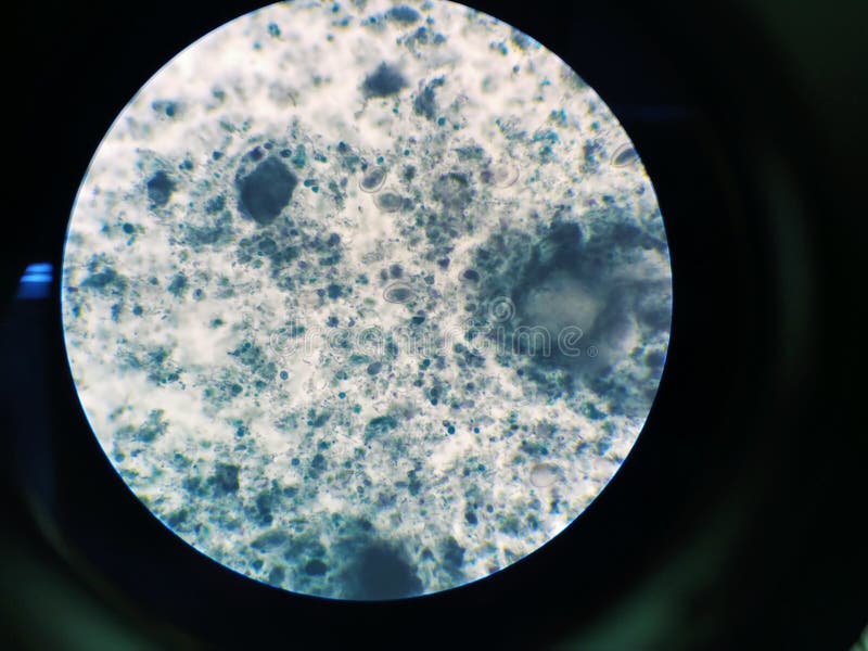 Giardia lamblia cyst stock image. Image of giardia, lamblia - 268926037