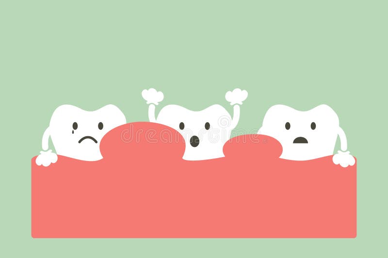 Gingivitis stock vector. Illustration of unhealthy, oral - 86440222