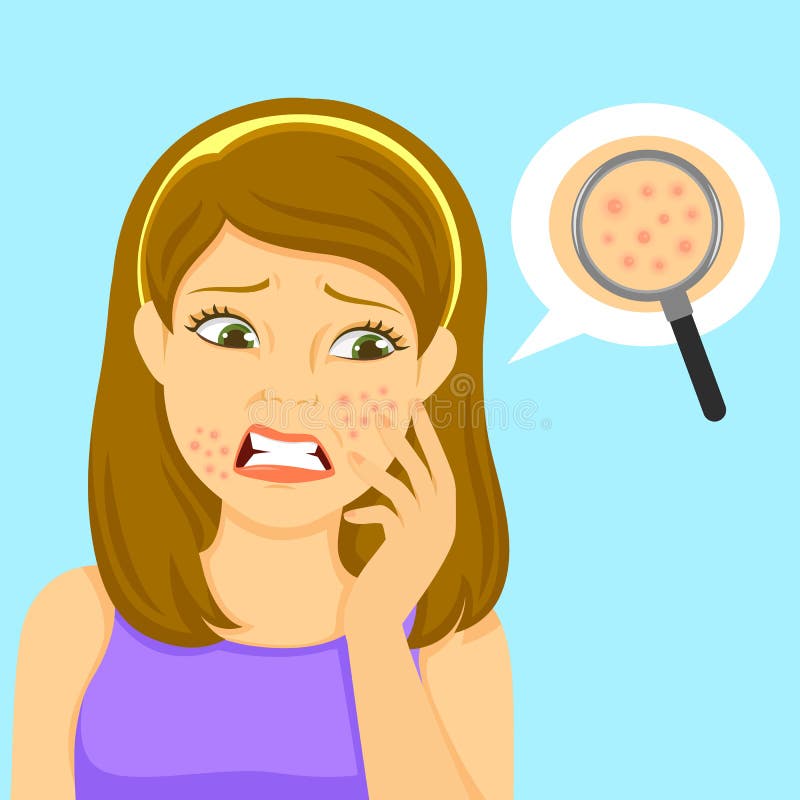 Girl with acne stock vector. Illustration of adolescence - 85251027