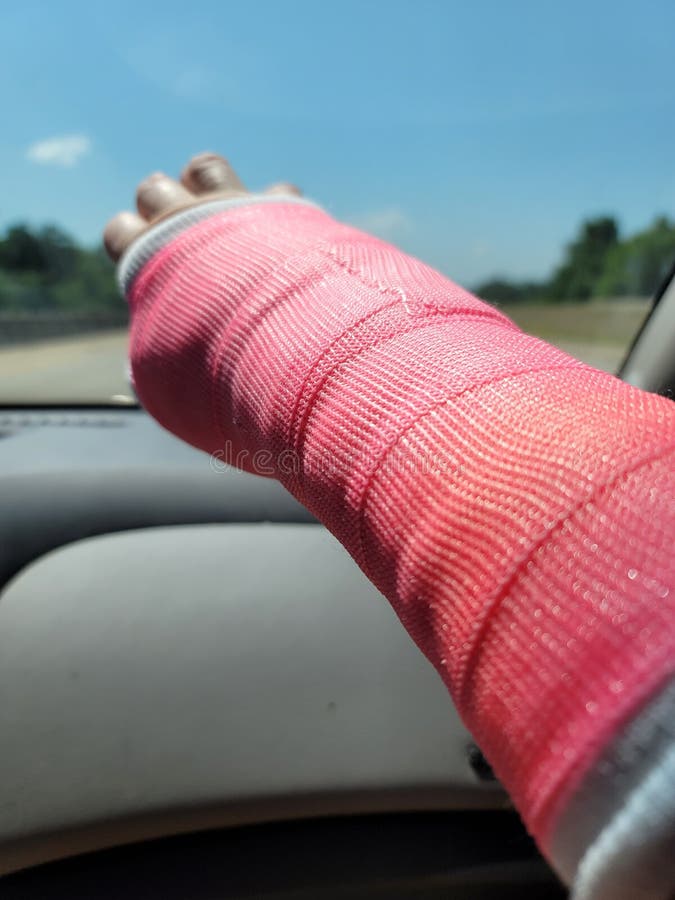 Broken Wrist Cast Pink