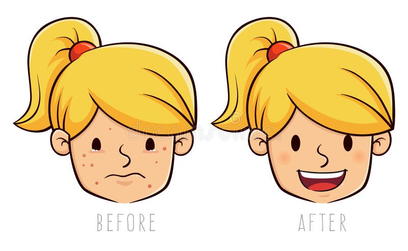 Girl Face with Acne Problem before and after Stock Vector ...
