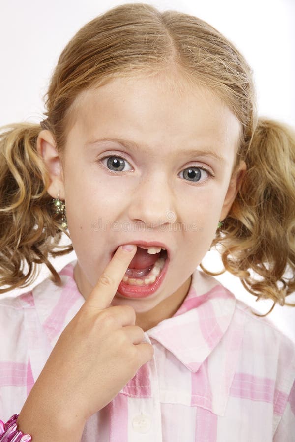 Girl missing tooth stock image. Image of grimace, girl - 484351