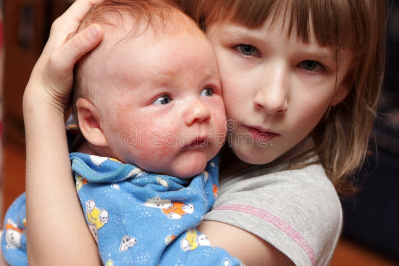 Girl pitied her brother stock image. Image of diathesis - 19674027