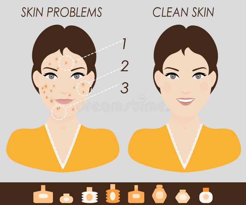 Problems Skin Stock Illustrations – 2,620 Problems Skin Stock ...