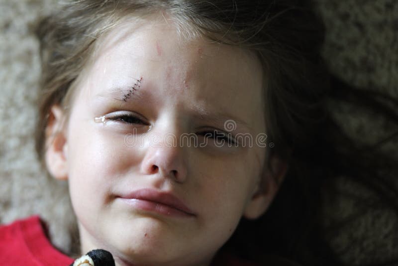 14+ Stitches girl Free Stock Photos - StockFreeImages