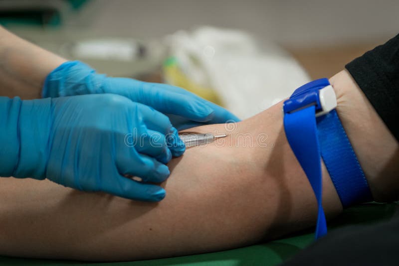 Patient Arm During Blood Transfusion With The Needle In The Skin Stock ...