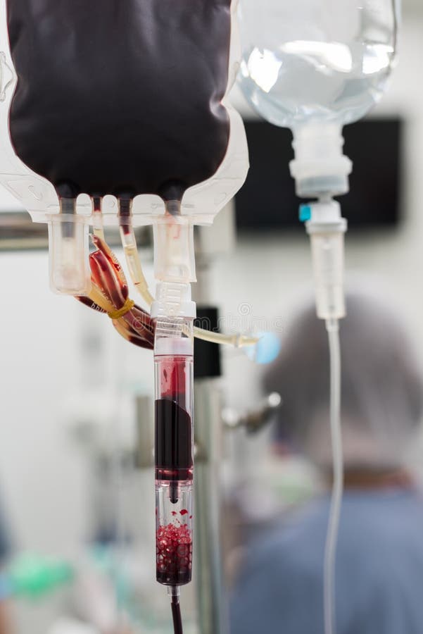 Giving Packed Red Cell during Surgery Stock Photo - Image of donor ...